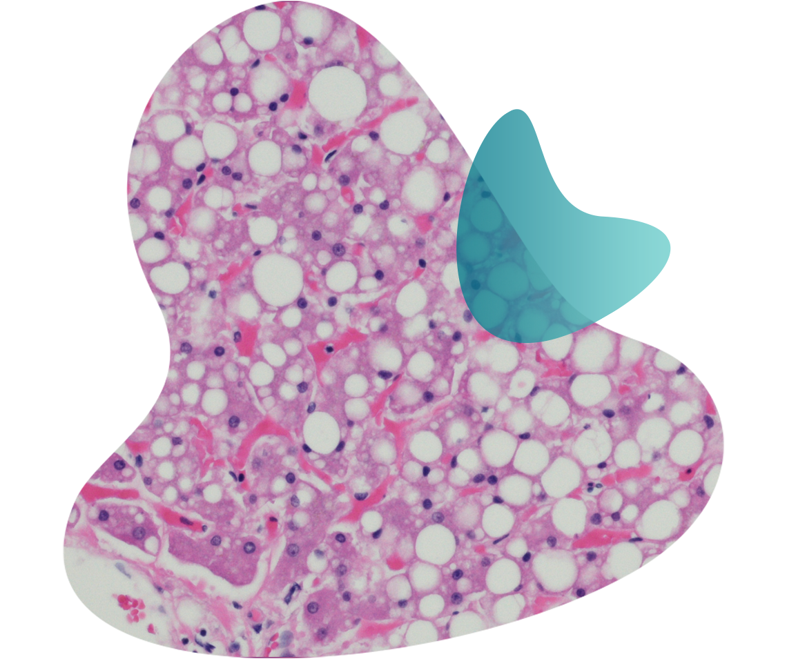 What’s the latest in ASO and siRNA technologies?